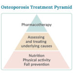 The controversy over bone drugs - Women's Health Network