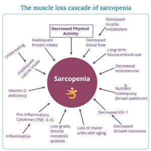 Are you at risk for sarcopenia? - Women's Health Network